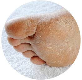 Clocip Antifungal & Anti-Bacterial Soap| Fight Fungus & Bacteria!