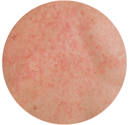 Clocip Antifungal & Anti-Bacterial Soap| Fight Fungus & Bacteria!